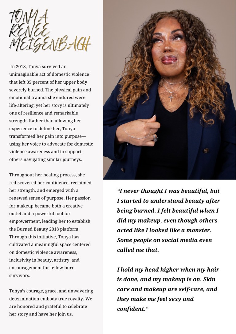 𝑼𝑯𝑴 interview with Beauty Influencer, and Burn/DV Survivor Tonya Renee ...
